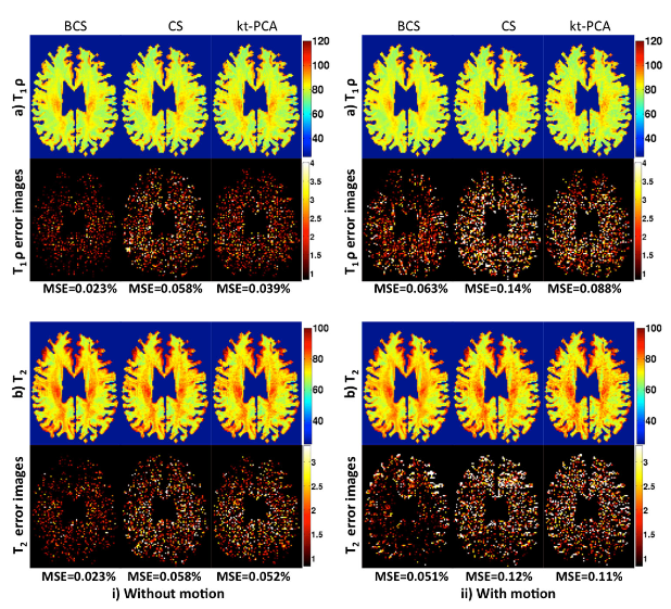 Blind Compressed Sensing (BCS) Dynamic MRI | The Computational ... Blind Compressed Sensing (BCS) Dynamic MRI | The Computational ...